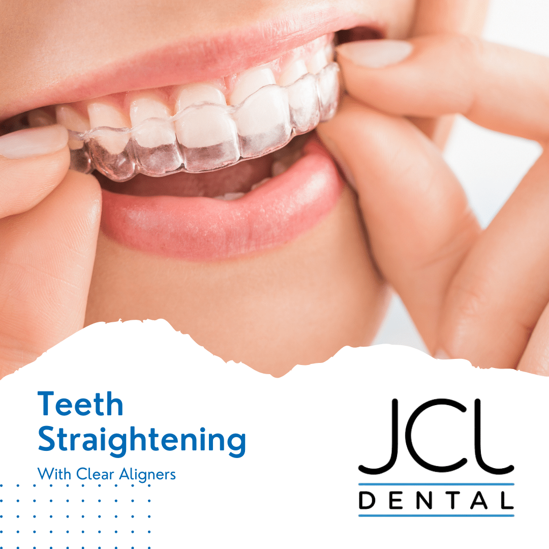 Clear Aligners near Murray Hill | Dentist Manhattan